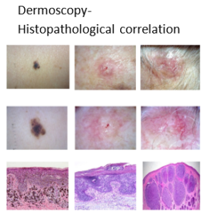 Galderma Research Award - Australian Dermatology Nurses Association