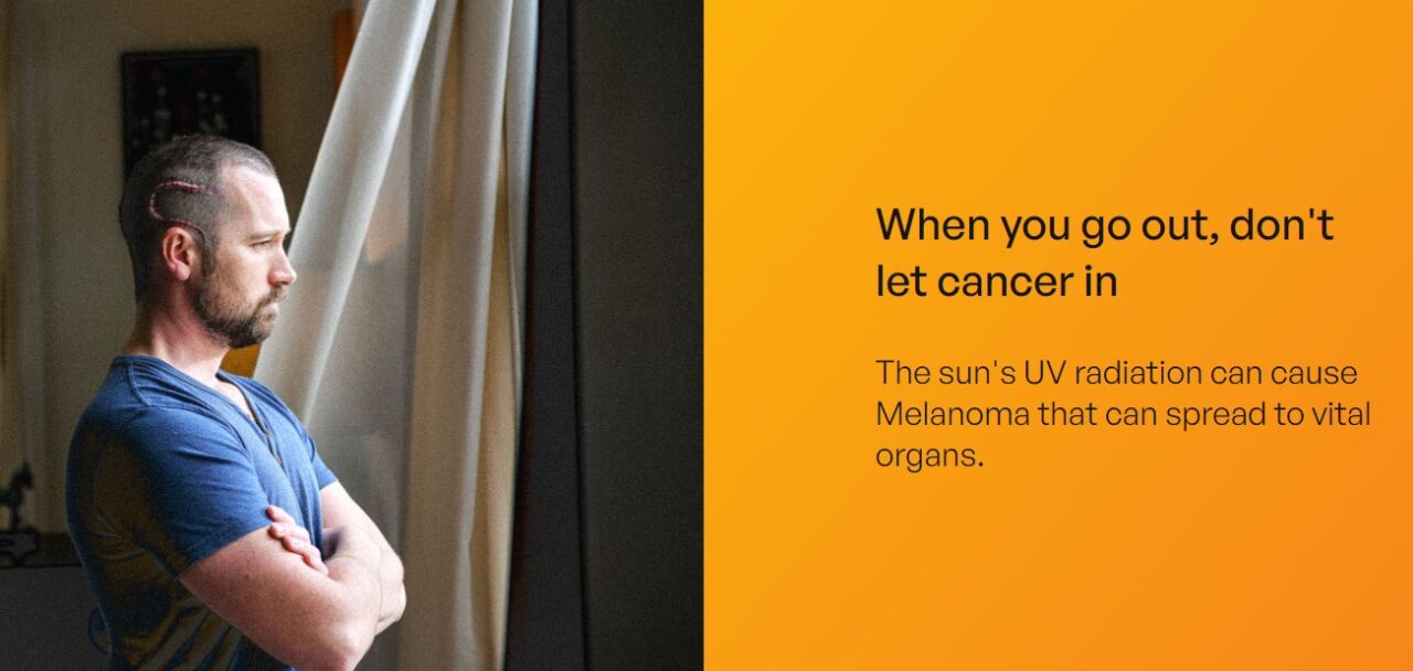 SunSmart Victoria launches new skin cancer prevention campaign to ...